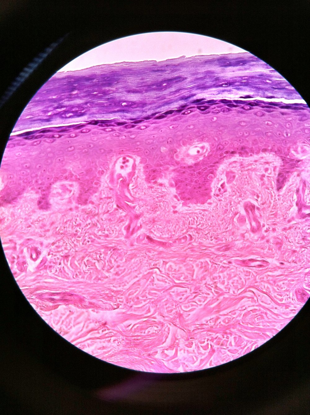Human Skin Cells Under Microscope 400x