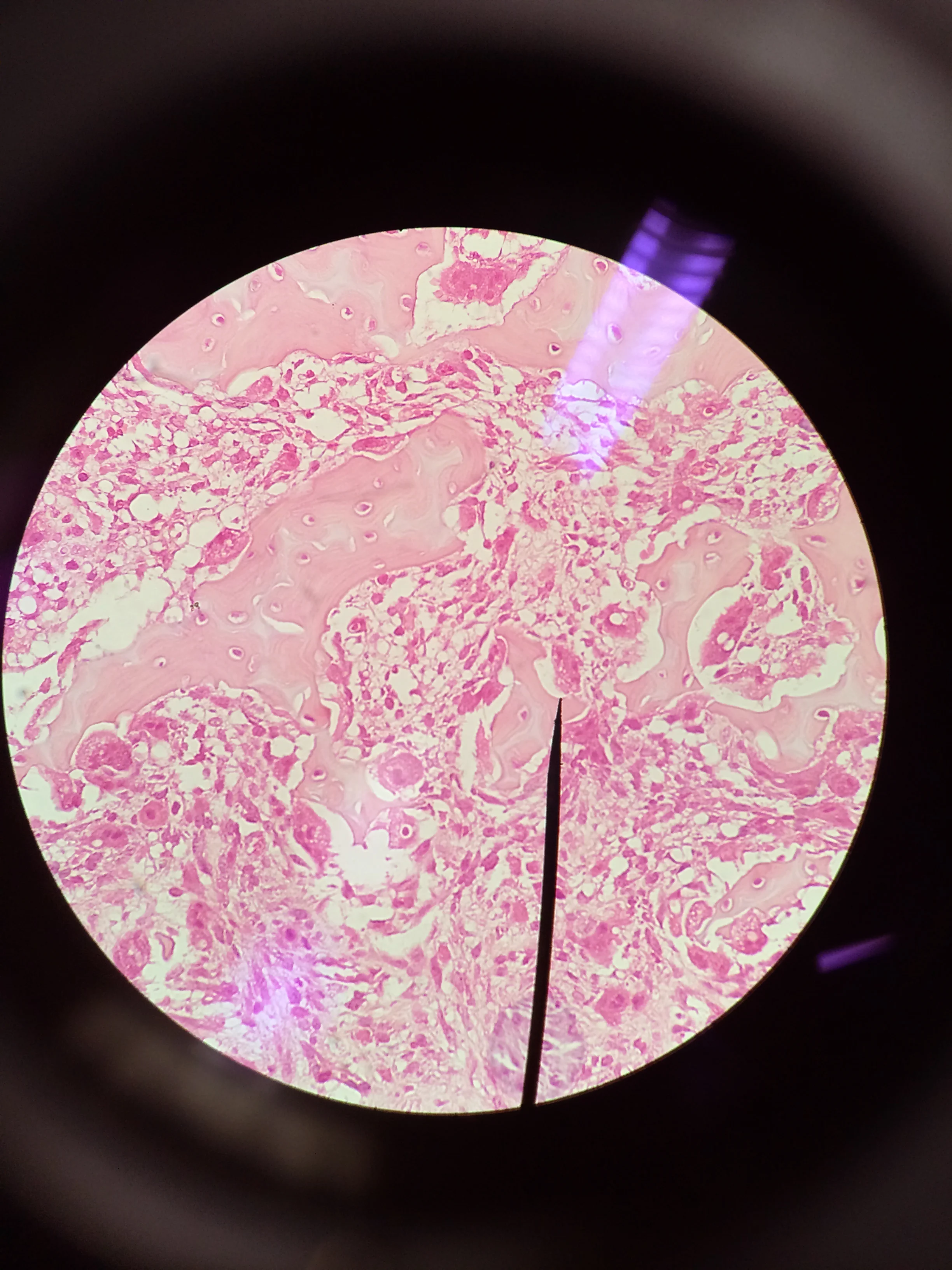 Bone Anatomy — See Why Anatomy