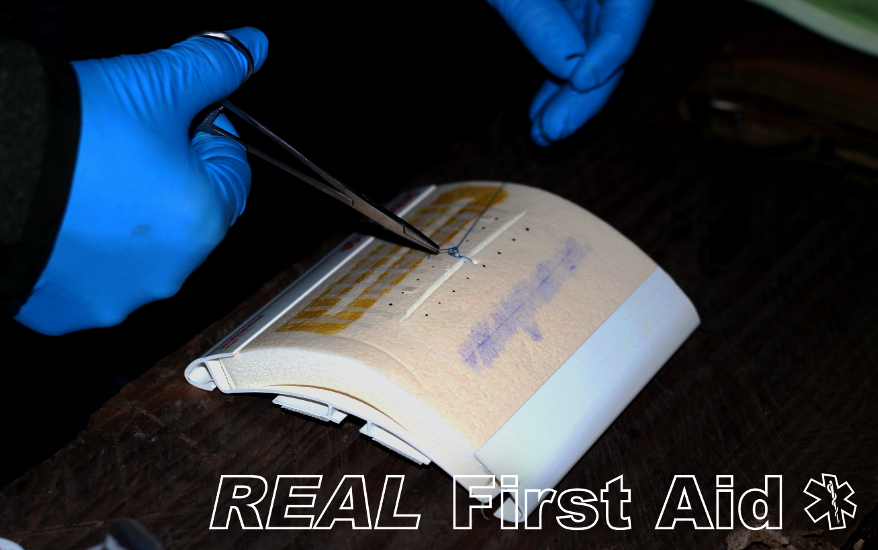 Prolonged Field Care — REAL First Aid