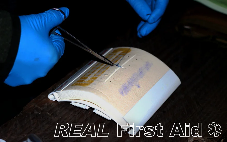 Prolonged Field Care — REAL First Aid