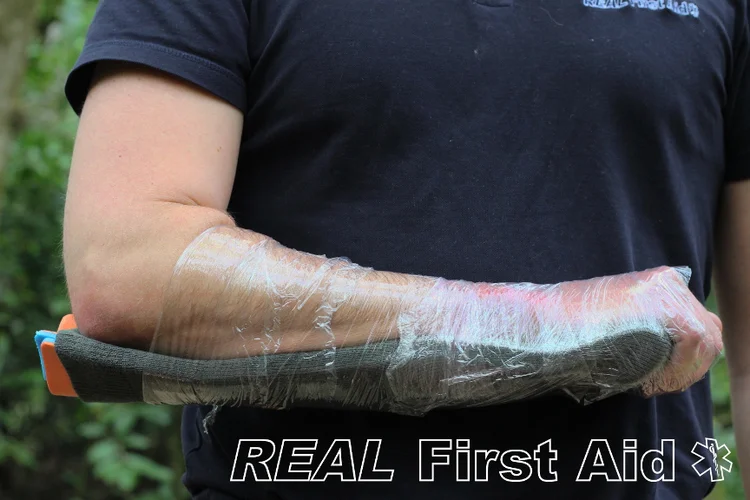 SAM Splints — REAL First Aid