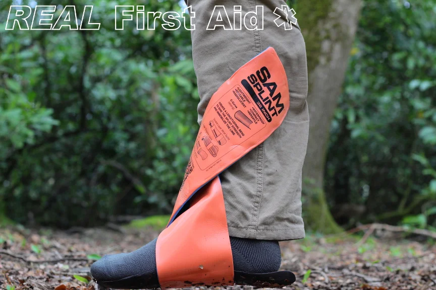 SAM Splints — REAL First Aid