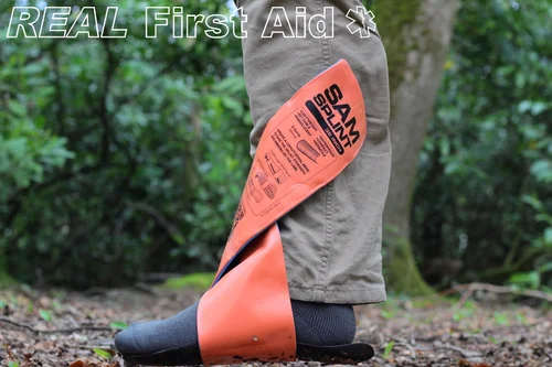SAM Splints — REAL First Aid