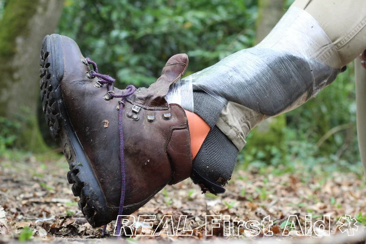 SAM Splints — REAL First Aid