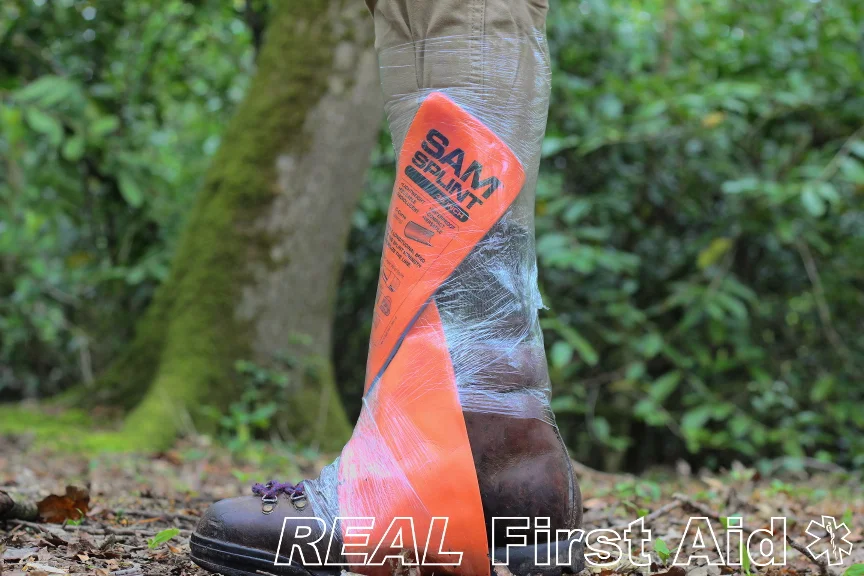 SAM Splints — REAL First Aid