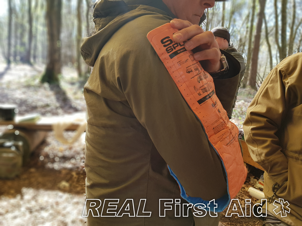 SAM Splints — REAL First Aid