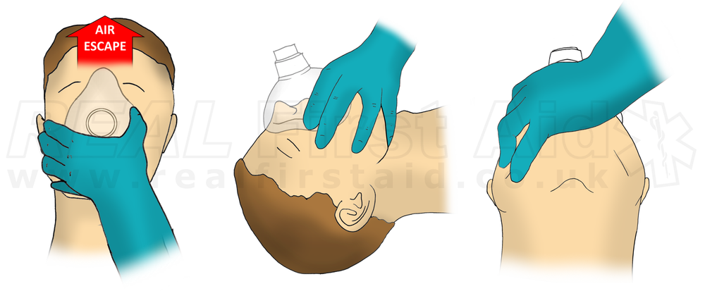 BVM Mastery — REAL First Aid