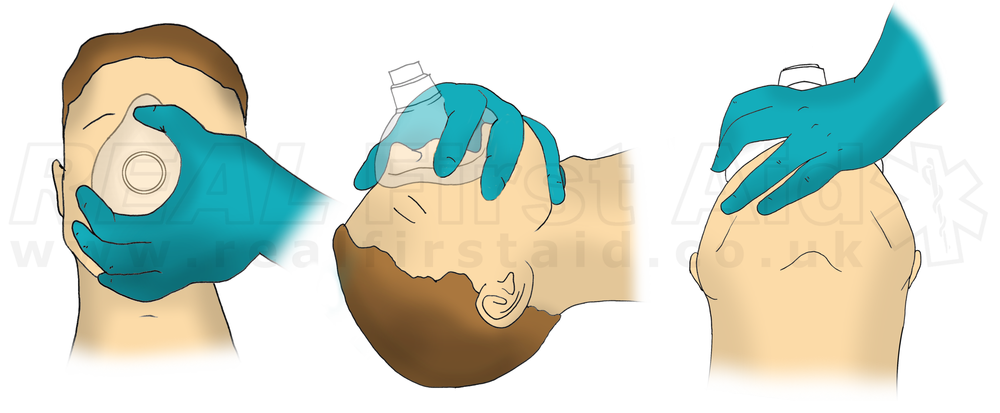 BVM Mastery — REAL First Aid