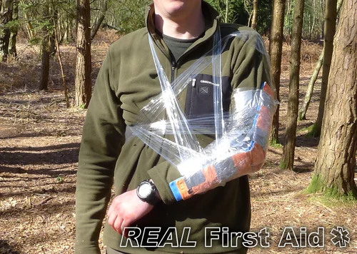 Cling Film? The Next Generation — REAL First Aid