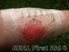 Cling Film? The Next Generation — REAL First Aid