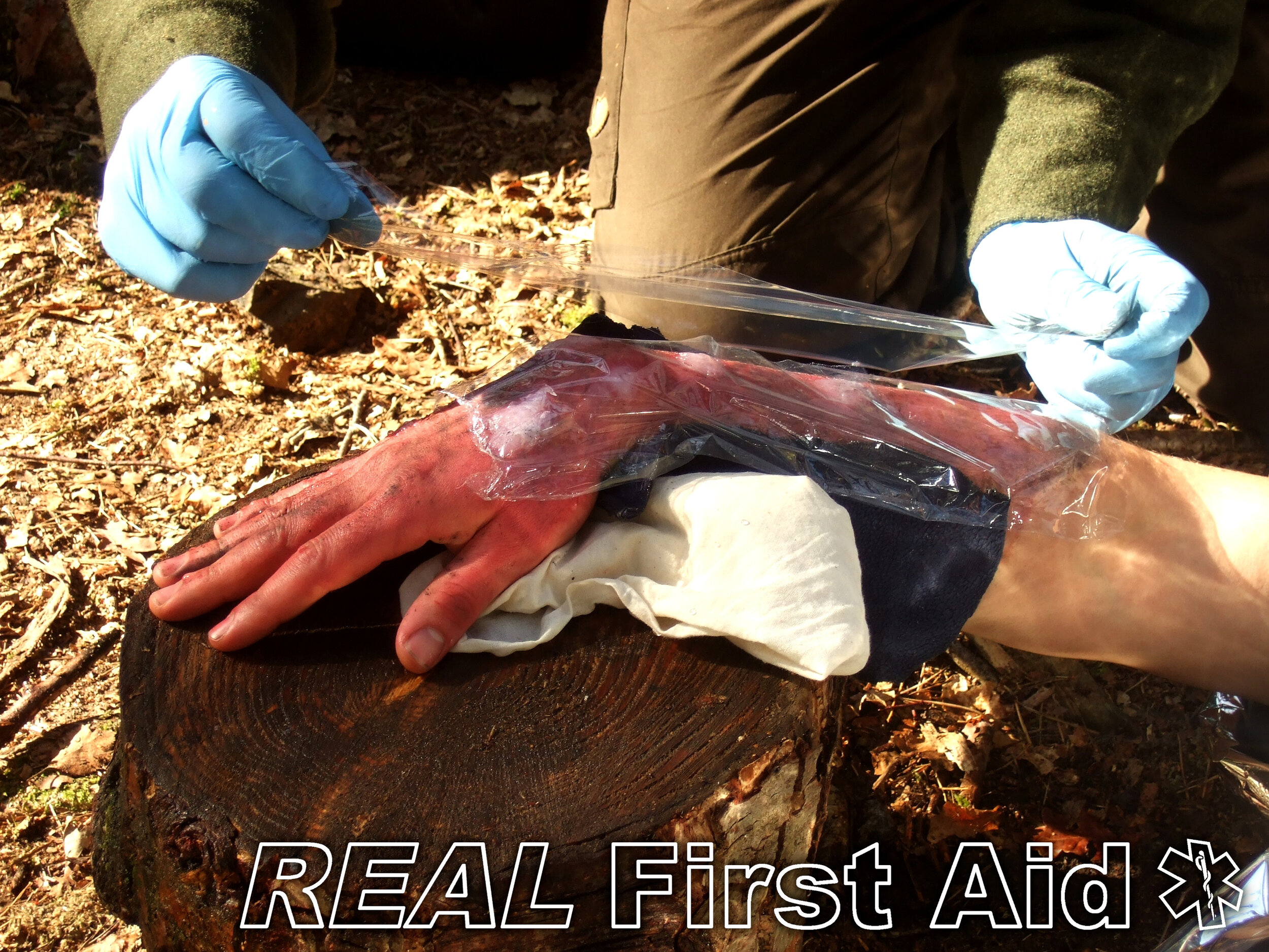 Cling Film? The Next Generation — REAL First Aid