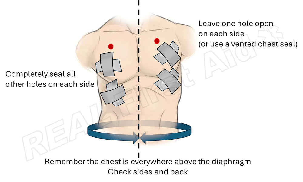 Open Chest Injury — REAL First Aid