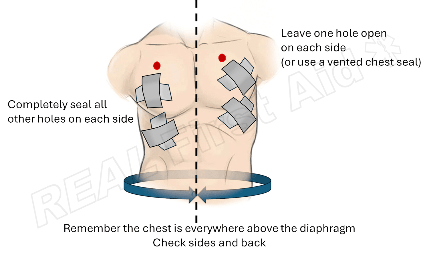Open Chest Injury — REAL First Aid