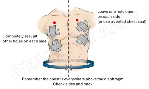 Open Chest Injury — REAL First Aid