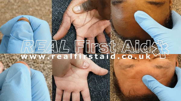 Big Sick or Little Sick - A rapid approach to casualty assessment and ...