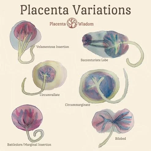 Placenta Variations