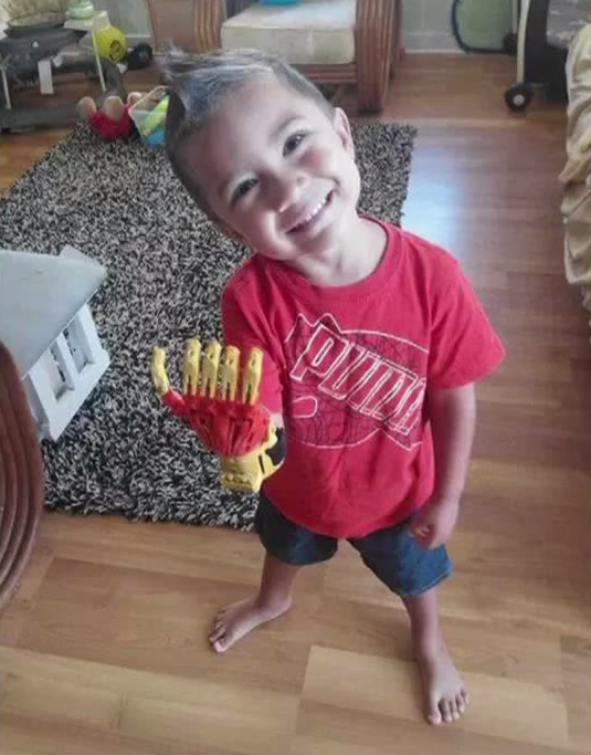 3-Year-Old Disabled Boy Gets Prosthetic IRON MAN Hand — GeekTyrant