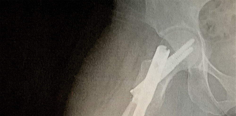 The Hardest Bone to Break — THE BITTER SOUTHERNER