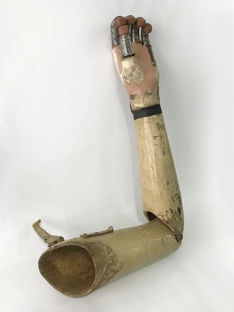 Victorian Prosthetic Arm