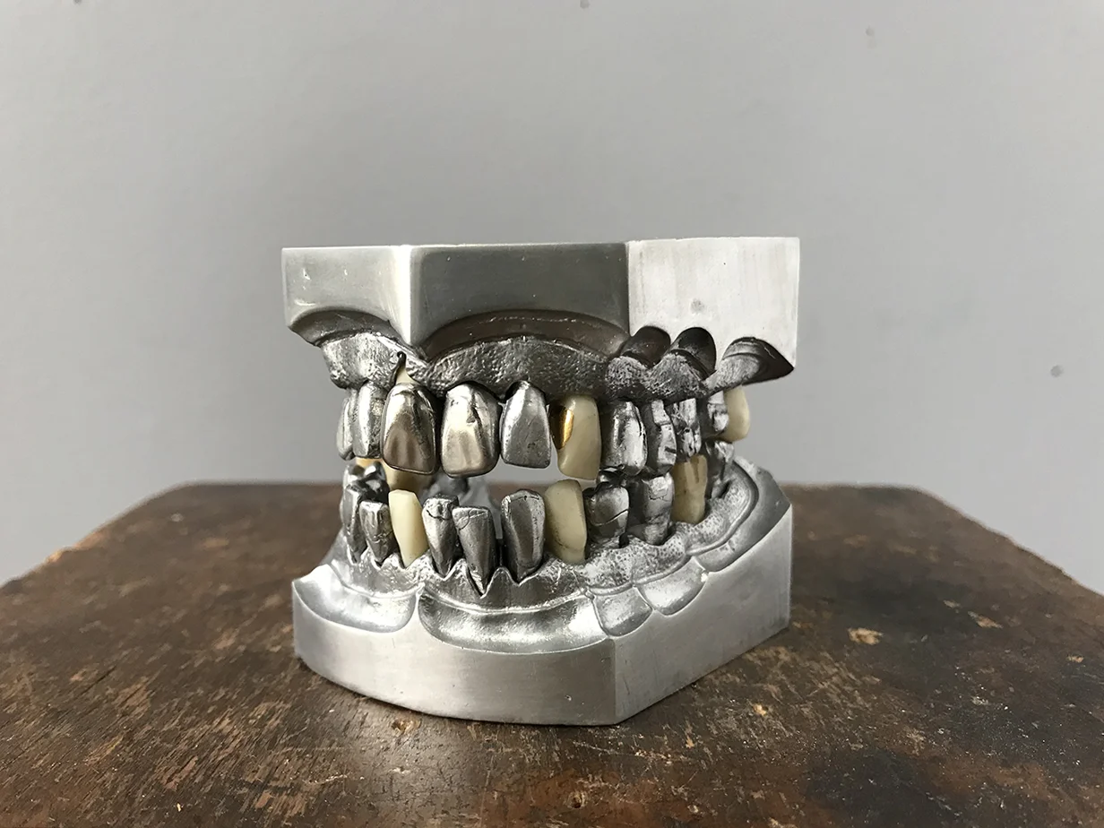 Aluminum Dental Teeth Set with Removable Teeth — AGENT GALLERY CHICAGO