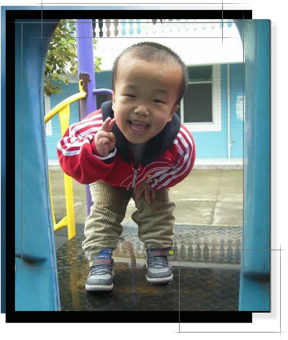 Little Person Syndrome Baby