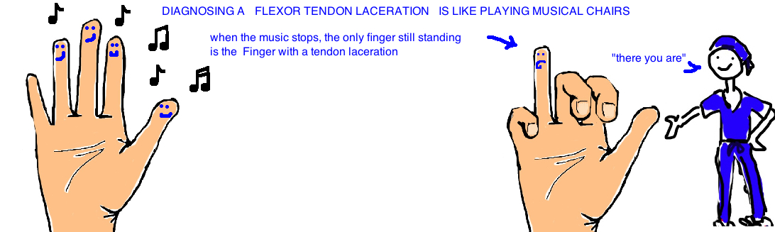 Hand Flexor Tendon Laceration — Bone Talks