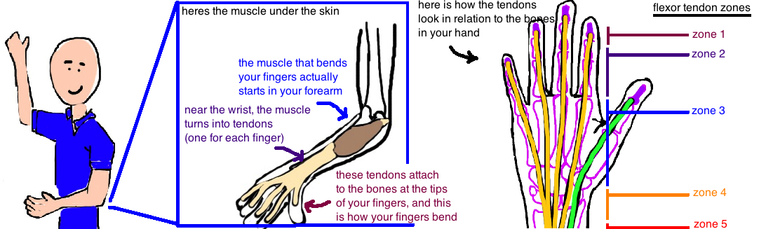 Hand Flexor Tendon Laceration — Bone Talks