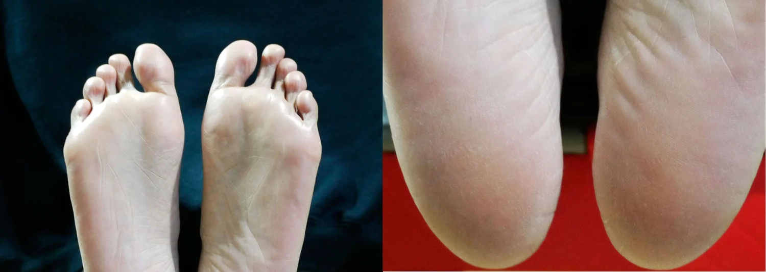 Worth The Splurge: Baby Foot is the cure for rough, cracked feet ...