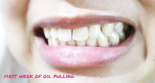 I tried oil pulling for a month. Here's what happened! — Project Vanity