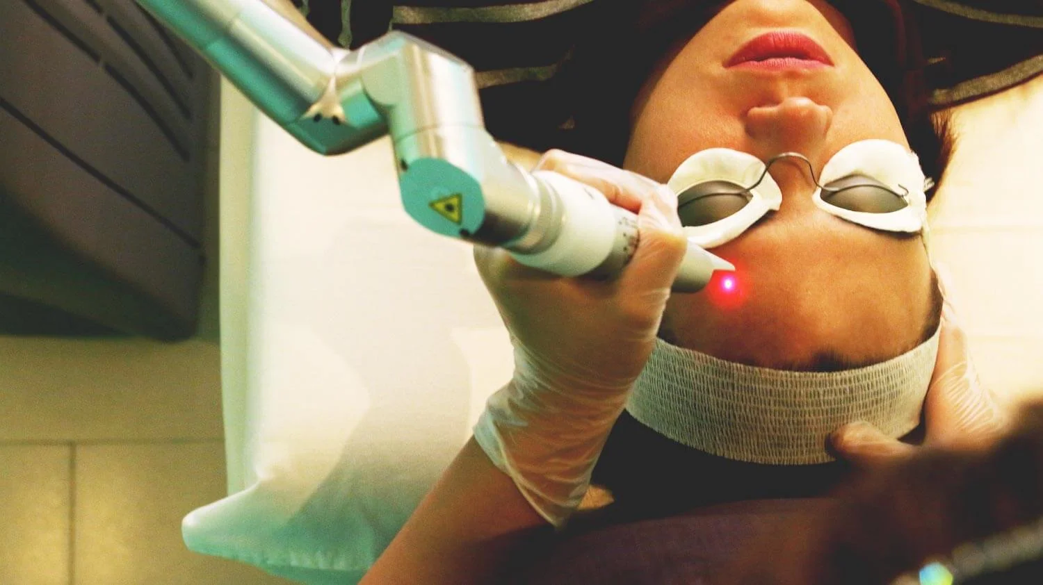 We asked a derma: Here's what you need to know about rosacea — Project ...