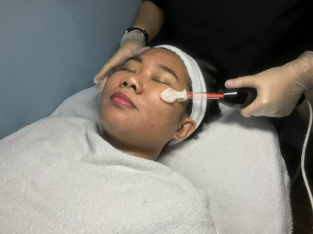 Here's how to survive a hormonal breakout, according to a dermatologist ...