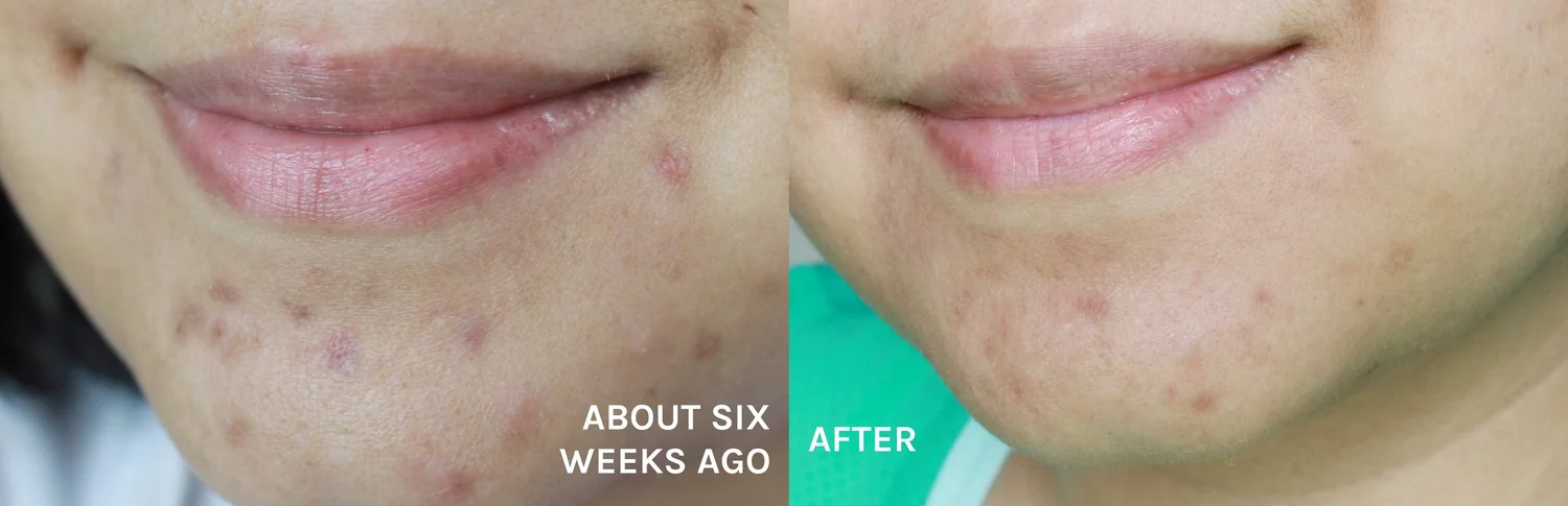 You need to try the new In Her Element Glow Job 5% Glycolic Gel Cream ...
