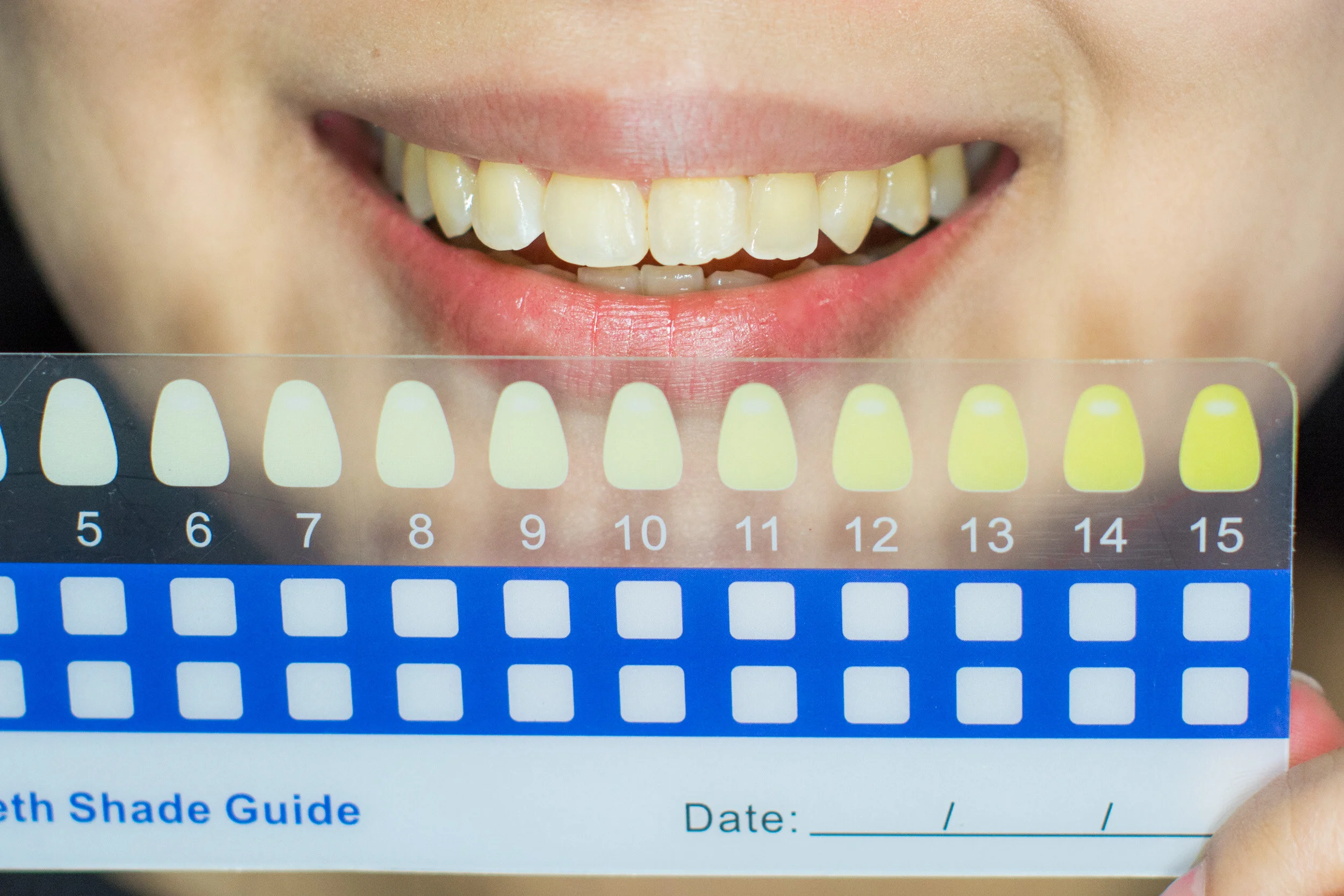 This new gadget actually whitened my teeth in seven days - seriously ...