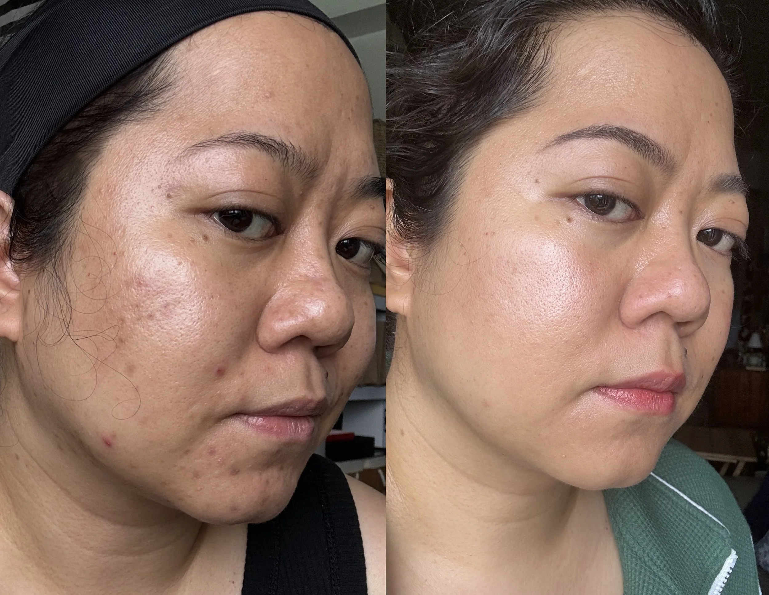 Skin Update: This Is Exactly Why You Need To See A Dermatologist ...