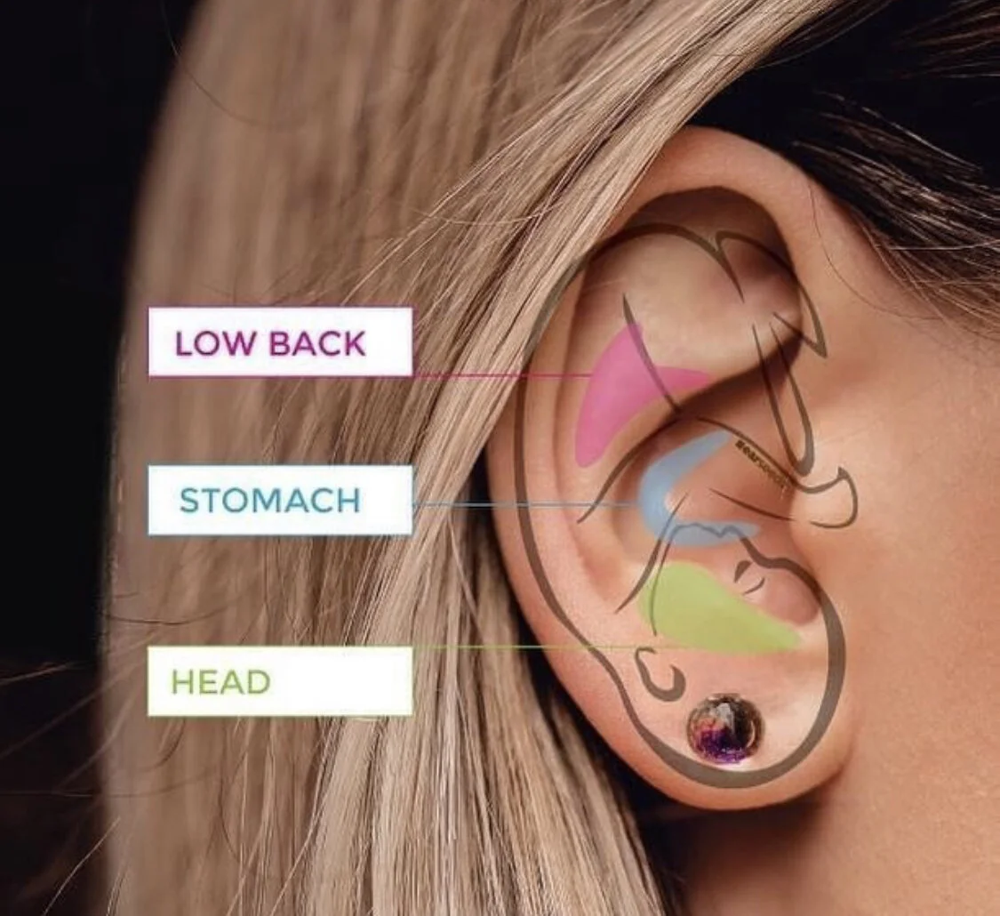 Ear Seeds Do They Really Work Life Point Acupuncture