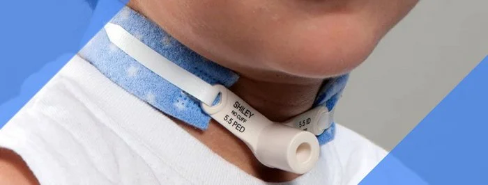 Traqueostomia em Pediatria - Coluna Pediatria por Dra. Carolina ...