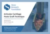 Articular Cartilage Paste Graft | Surgical Technique Video — Stone ...