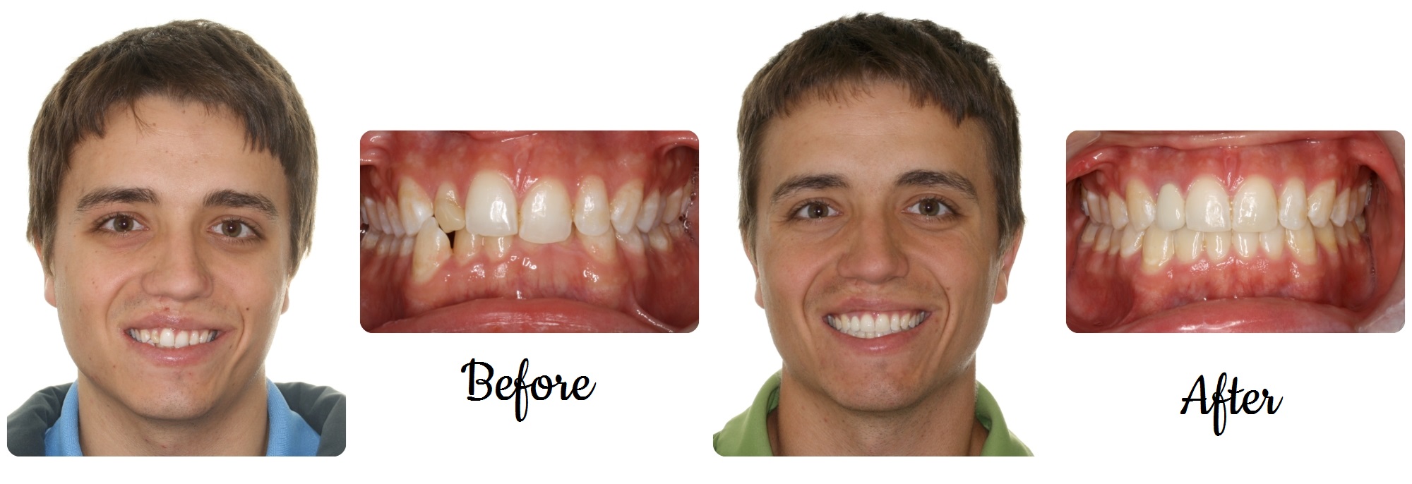 Fort Orthodontics | Dr. Sunny Leong and Dr. Justin Kim | Braces ...