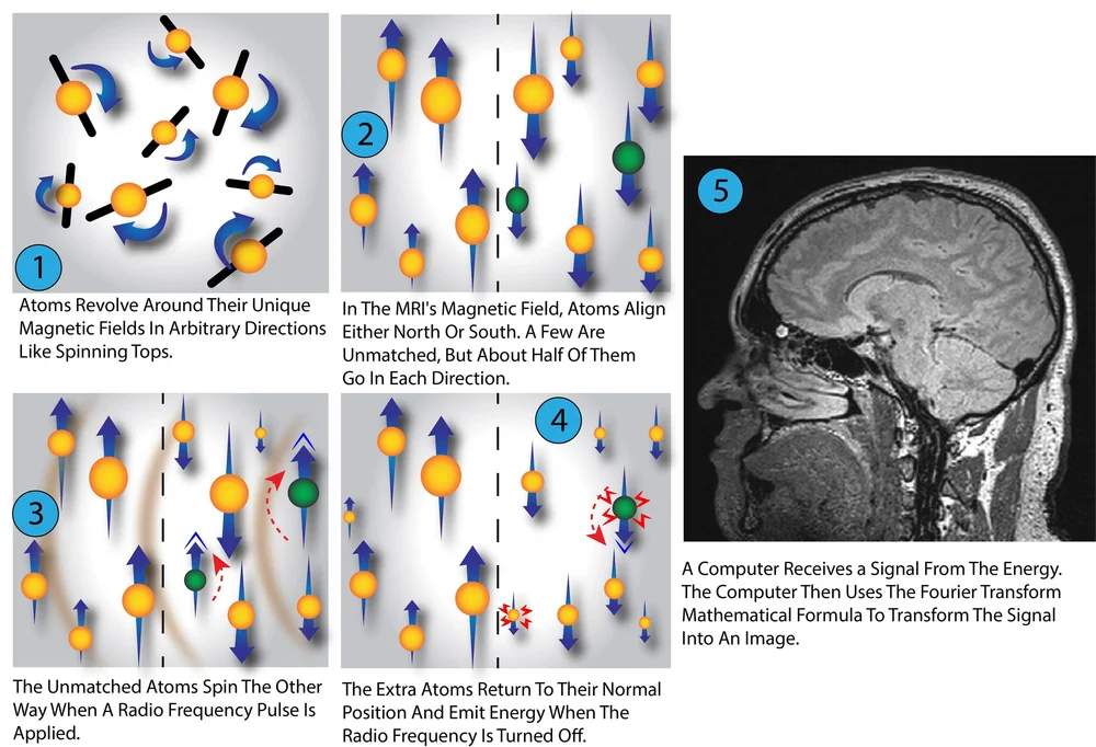 MRI Technologies Overview — So-Cal Engineer