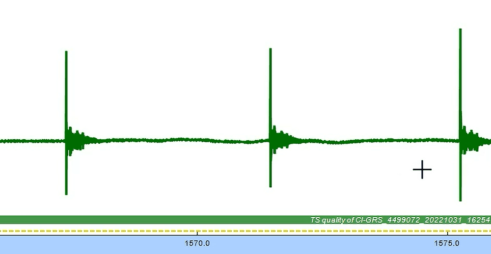Gunshot Location Technology using Acoustic Data