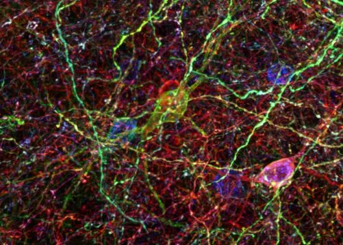 Brain Plasticity — Conte Center at Harvard