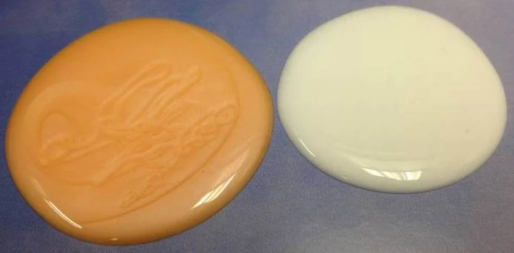 Scalp Discoloration ... from a Shampoo? — Donovan Hair Clinic