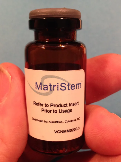 Is ACell/Matristem available in Canada yet? — Donovan Hair Clinic