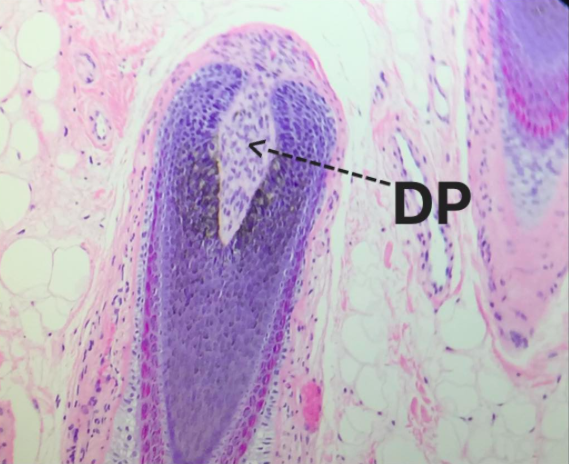 Dermal Papilla (DP) — Donovan Hair Clinic