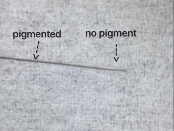 How can one identify a telogen hair? — Donovan Hair Clinic