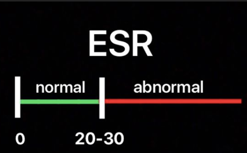 Does Elevated ESR Cause Hair Loss Donovan Hair Clinic Does Elevated ESR Cause Hair Loss Donovan Hair Clinic