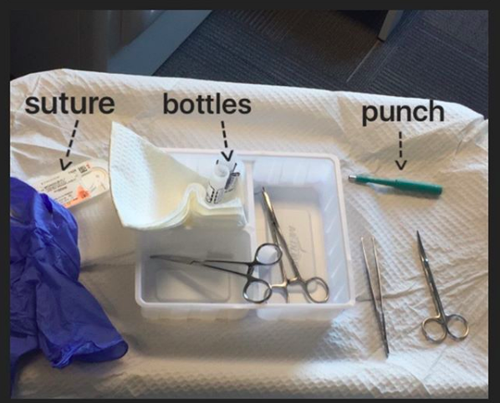 Scalp Biopsies: Set Up — Donovan Hair Clinic