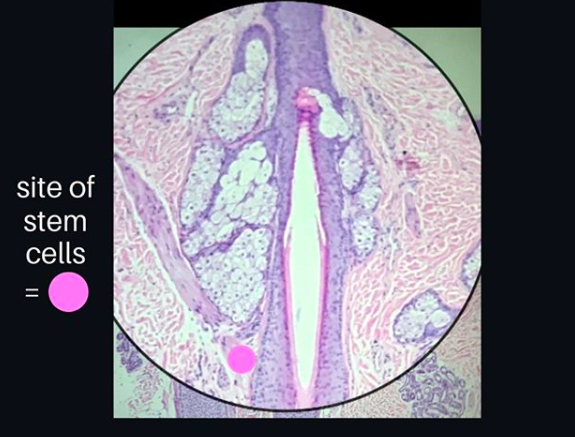 The Bulge: The Location of Follicular Stem Cells — Donovan Hair Clinic