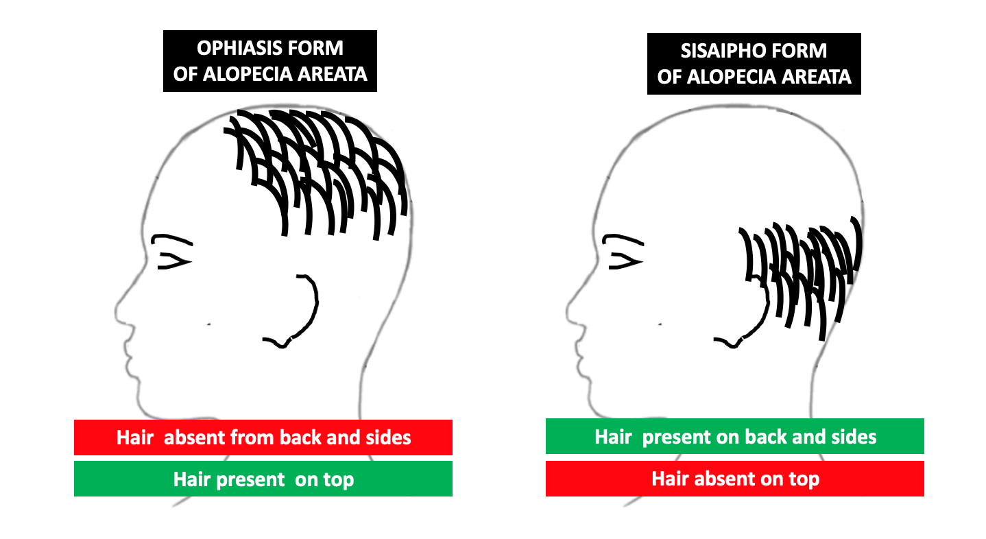 Dr. Donovan's Hair Loss Articles (2011-2020) — Donovan Hair Clinic