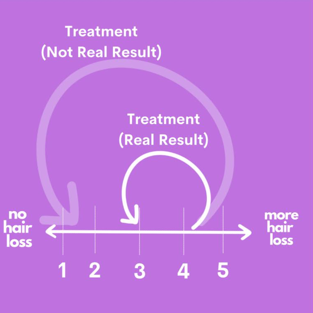 Treatment of Female Pattern Hair Loss: Why do I still see miniaturized ...